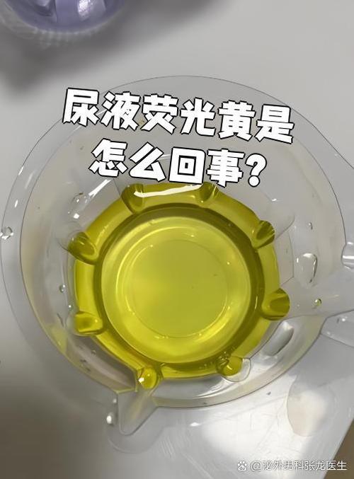 正常人尿液颜色图标