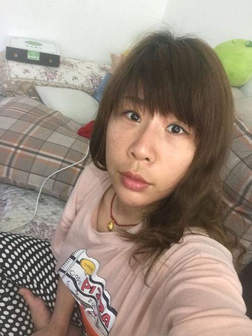 苹果手机前置拍照反了