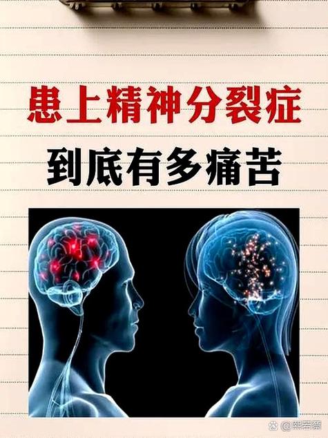 精分是大脑病变还是心理问题图标