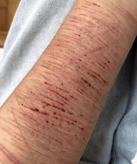 抑郁症会拿刀捅人吗图标