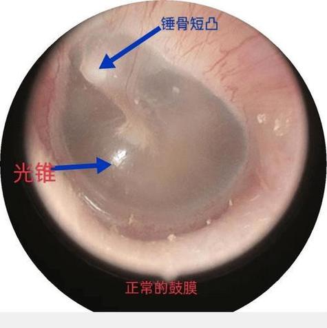 蓝牙耳机里的那层膜掉了怎么办图标