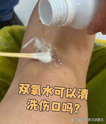 二次清洁有必要吗