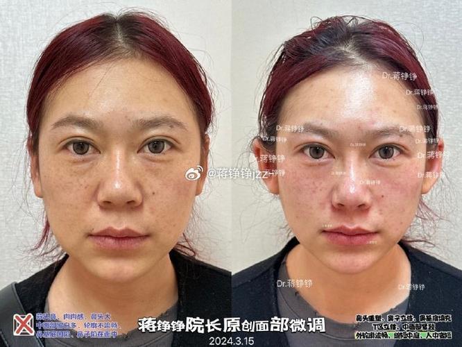 怎么改变脸部凹凸图标