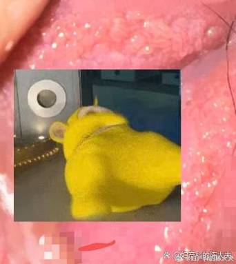 柚子里边颗粒很硬图标