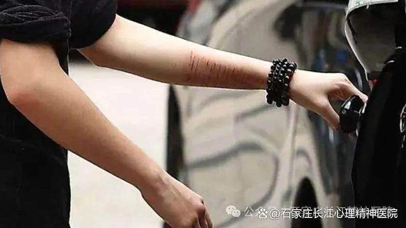 抑郁症划手臂要阻止吗图标