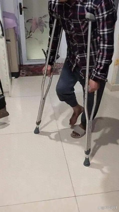 胫腓骨取钢板要拄拐吗图标