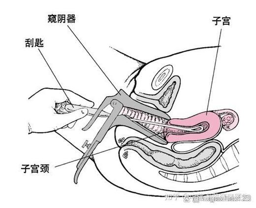 清宫疼不疼图标