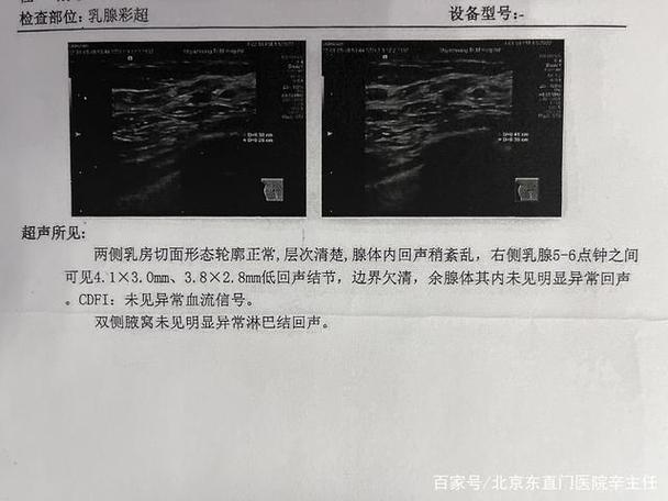 电脑前置音频没声音图标