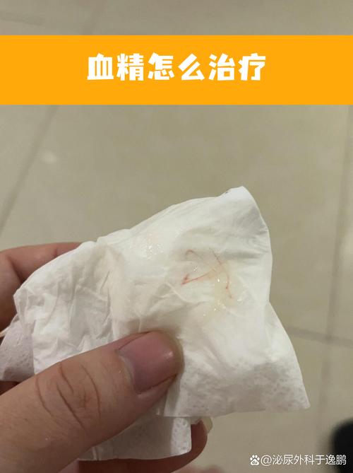 精血是从哪里流出来的图标
