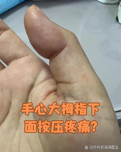 手掌关节痛什么原因