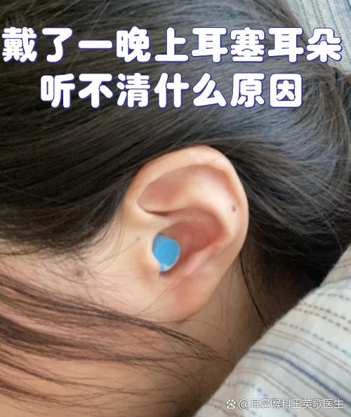 耳塞可以戴一晚上吗截图