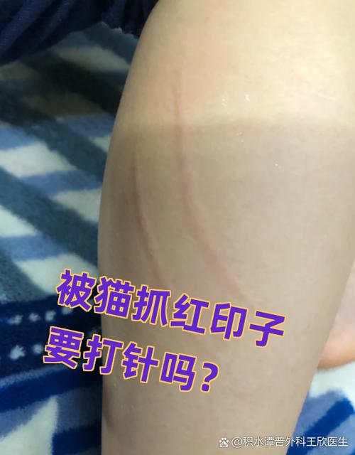 身上莫名出现猫抓痕图标
