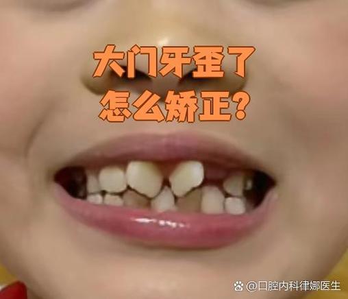 门牙歪了一颗可以只矫正一颗吗图标