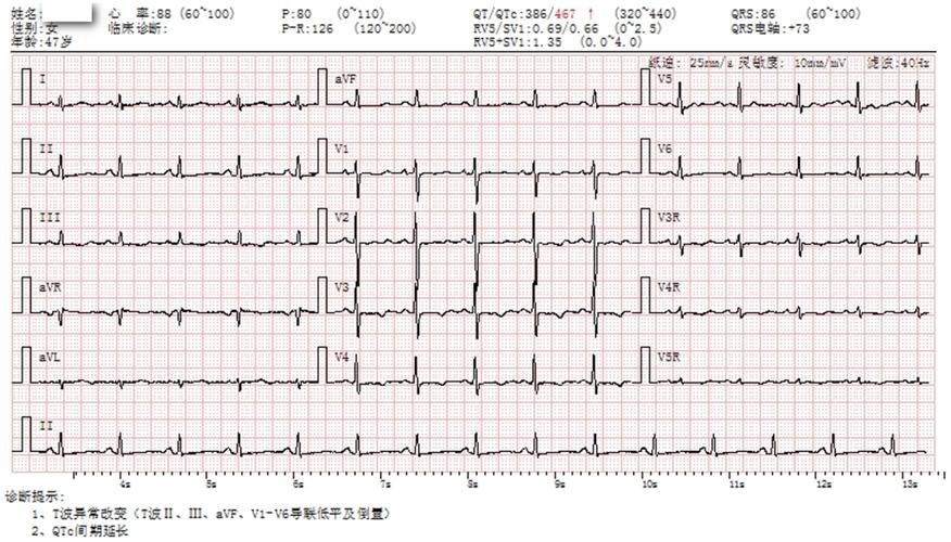 qtc高怎么办