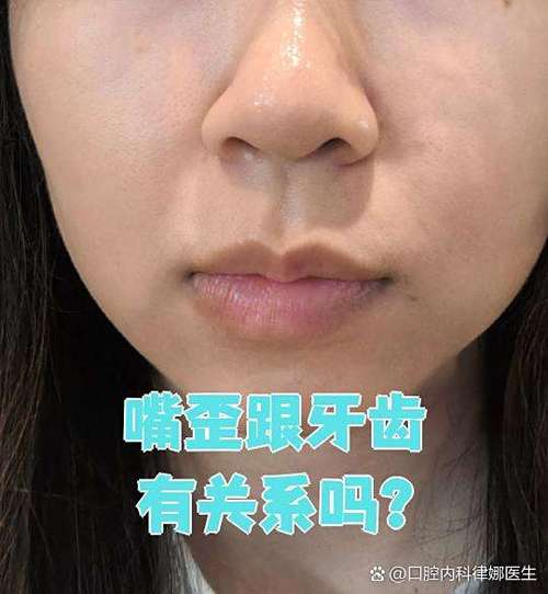 嘴歪跟牙齿有关系吗图标