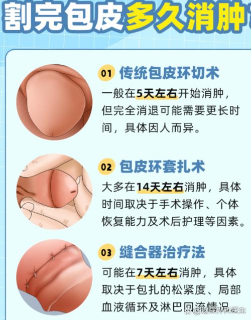 割阴手术需要多久能恢复图标