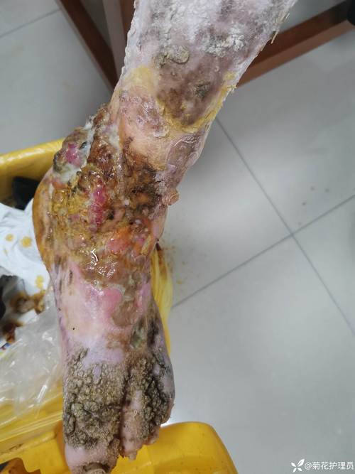 小米蕉受伤吐血视频