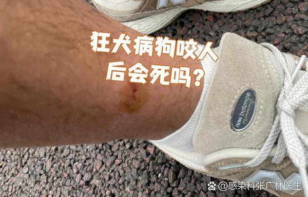小狗咬了人会死吗图标