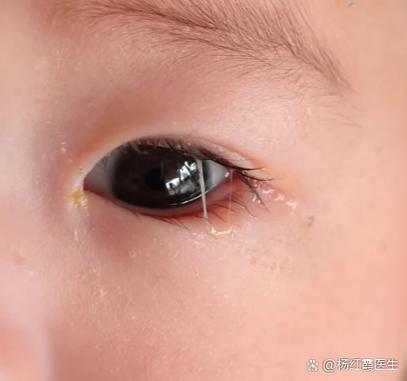 小孩眼睛流眼泪图标
