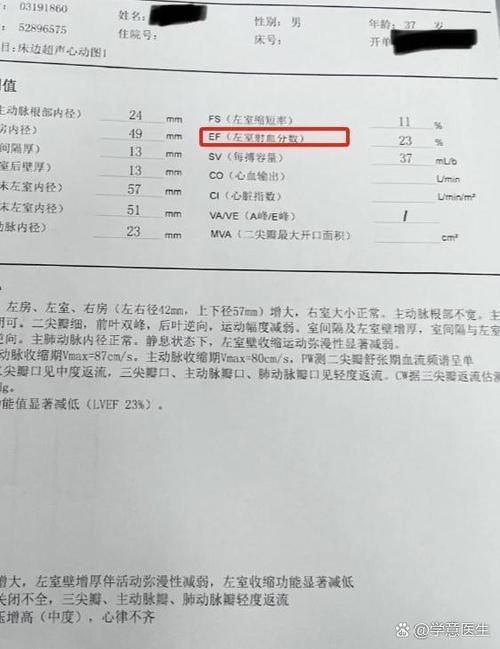 左室收缩功能EF和FS正常值图标