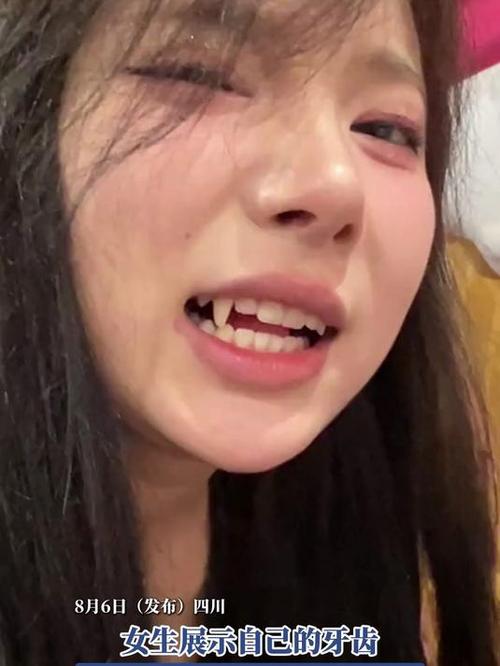 虎牙是哪颗牙齿图标