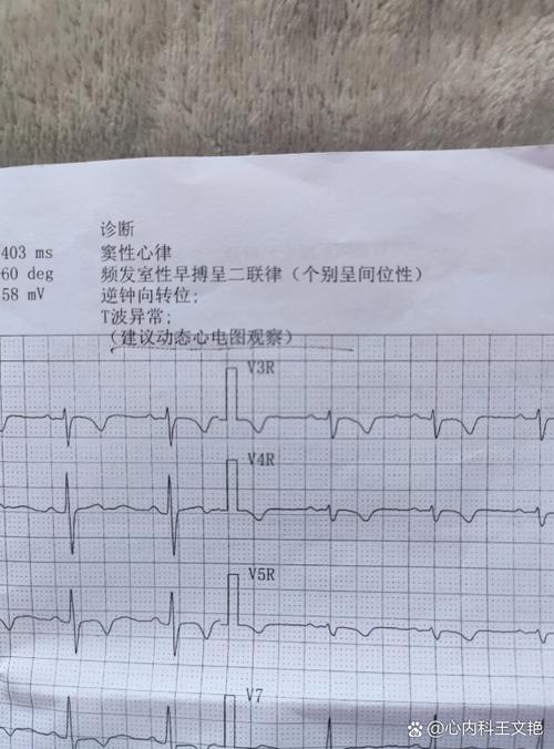 什么人容易室性早搏截图