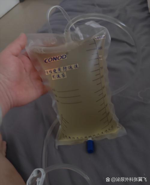 排尿困难是什么原因图标