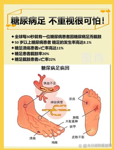 糖尿病并发症恶化征兆图标