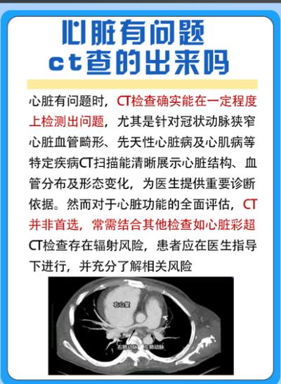 做ct能检查出什么图标