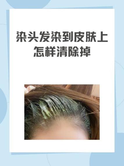 拆完头发上有胶怎么办图标