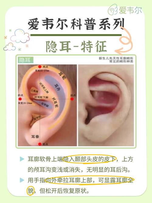 睡觉的时候耳机不见了,醒来也找不到图标