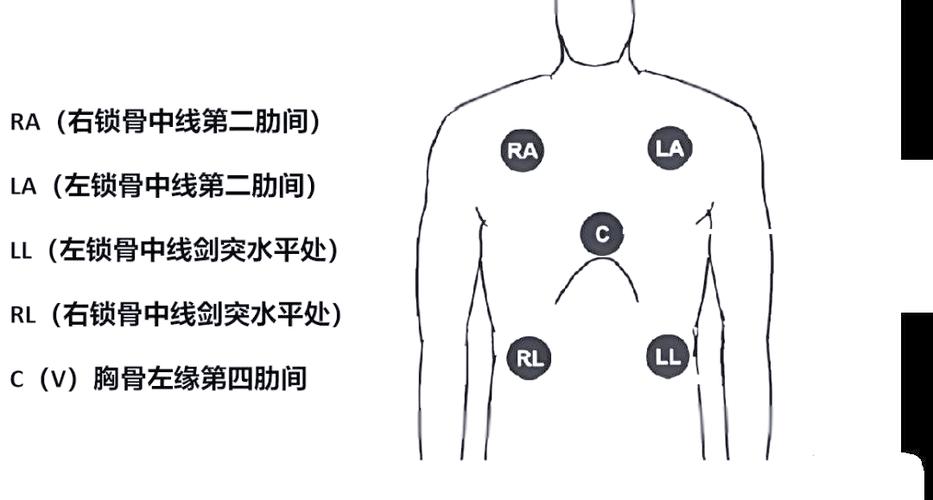 心电监护仪开关在哪里截图
