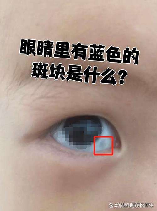 皮肤上有蓝色斑点图片图标