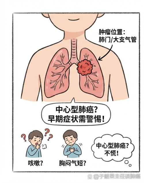 肺部肿瘤怎么治疗效果最好图标