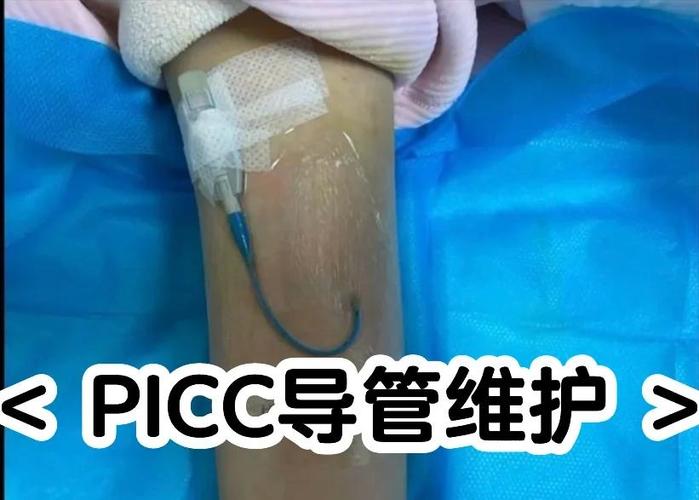 picc维护的图片截图