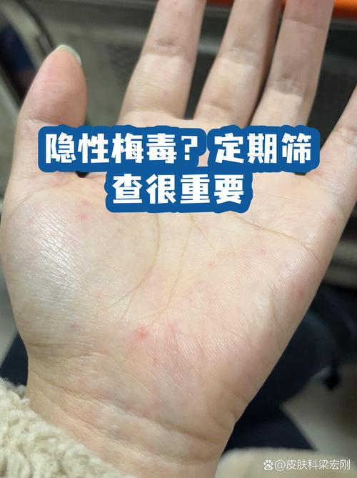 csgo枪皮肤突然消失图标