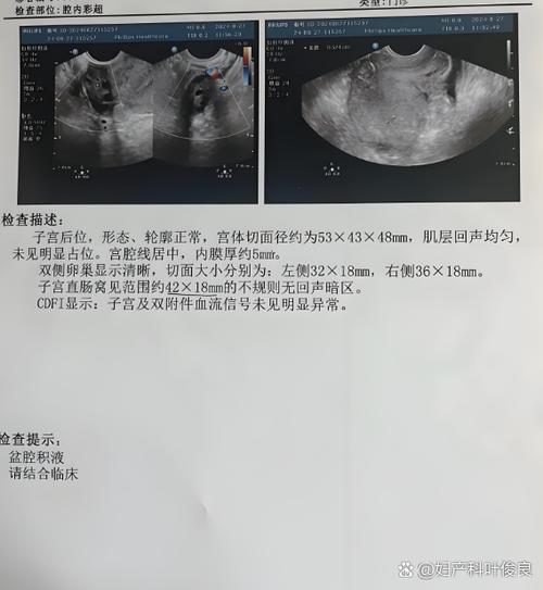超声与彩超的区别图标
