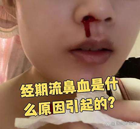 姨妈没来流鼻血了怎么回事截图