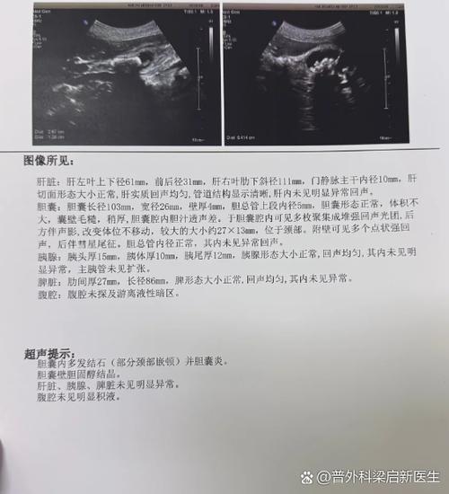 包块暗区截图
