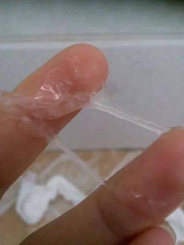 女的下面出来白色分泌物图标