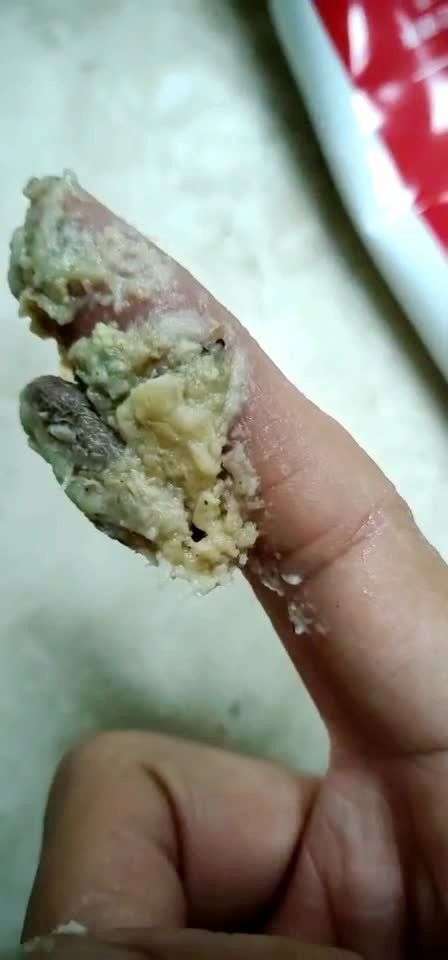 济爱用了50颗效果
