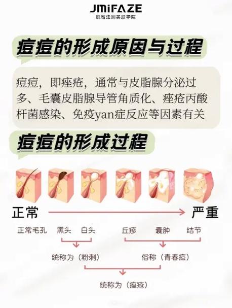脸上长痘痘是什么原因图标
