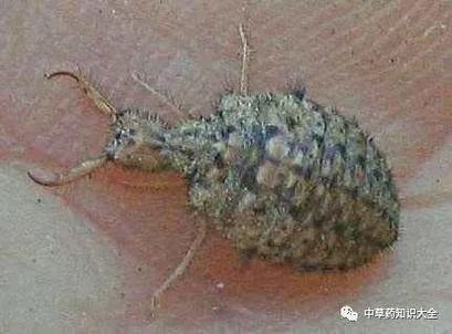 ANT是什么疾病图标