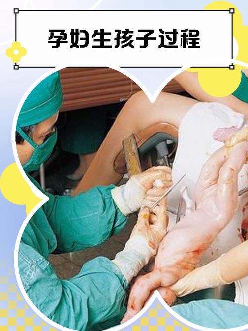 discovery孕妇分娩图标
