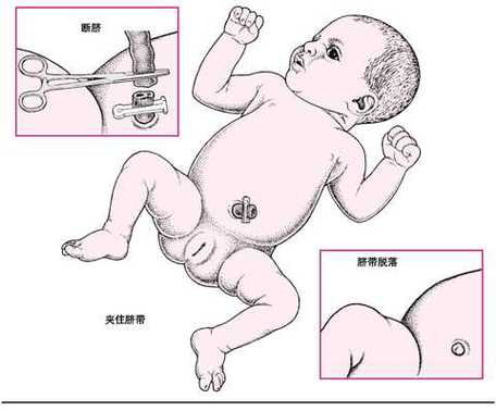 宫外孕打针一般打几针图标
