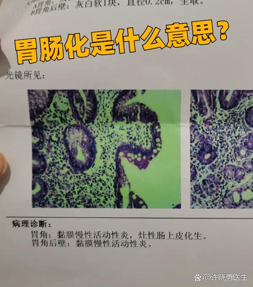 化生是什么意思