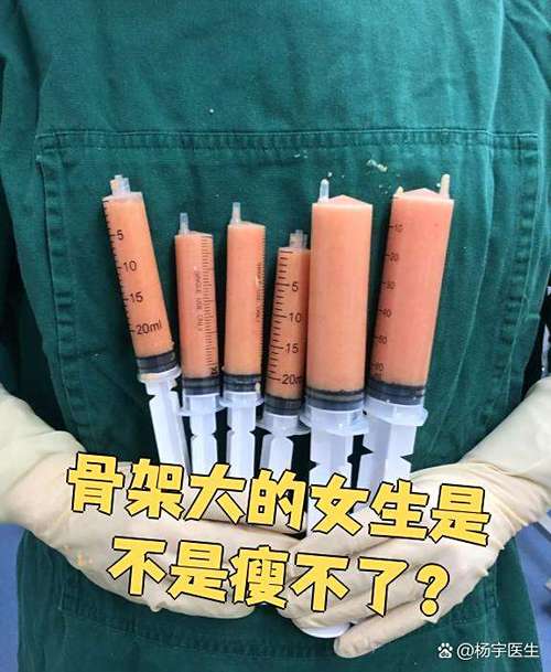 大骨架的人瘦了好看吗图标