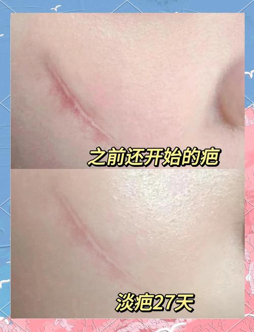 抖音疤痕特效在哪里图标
