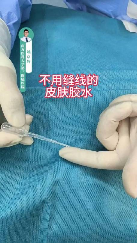 什么胶可以粘皮肤截图
