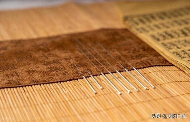 银针入体真的会游走吗截图